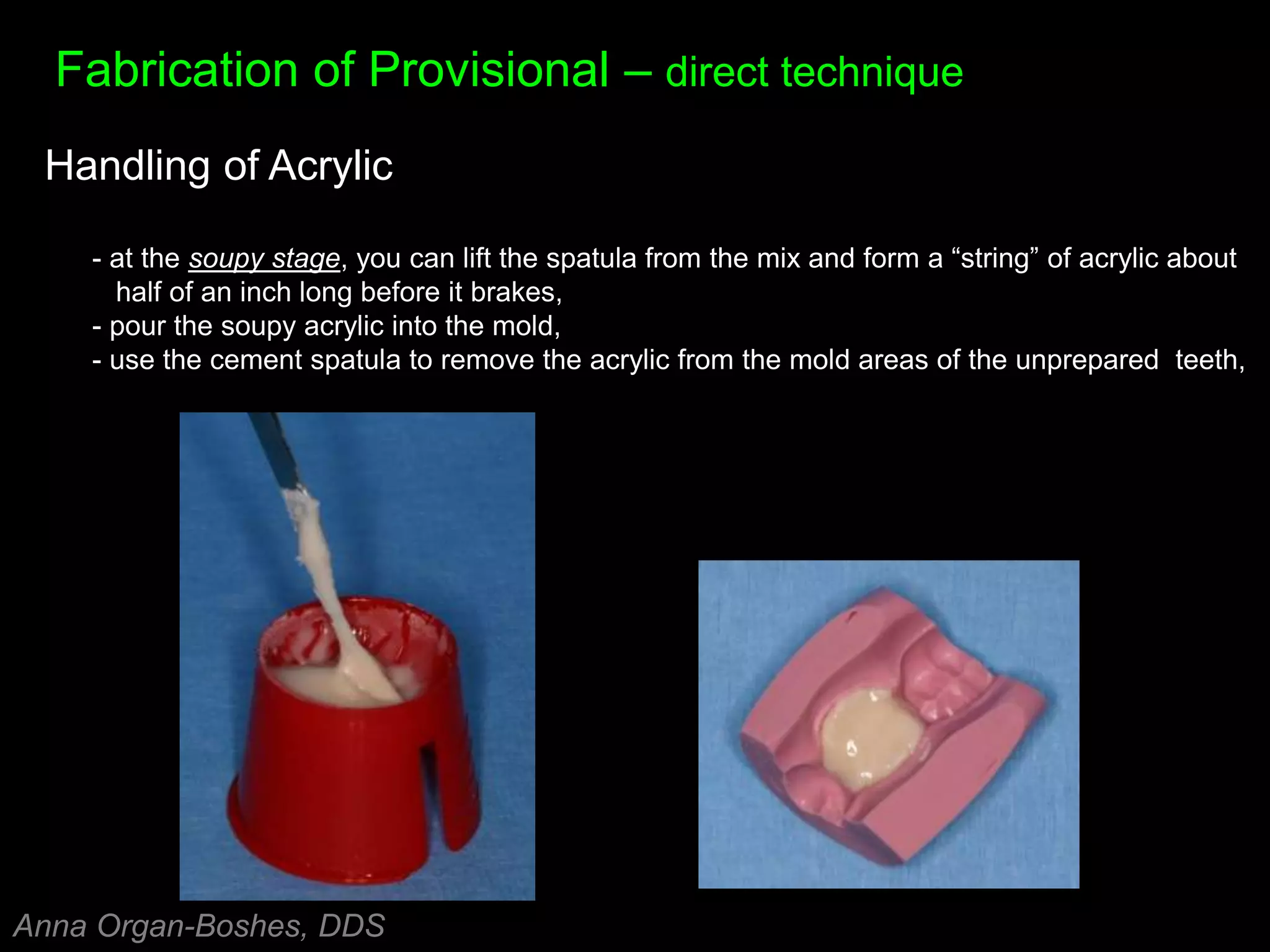 Full gold crown preparation | PPT