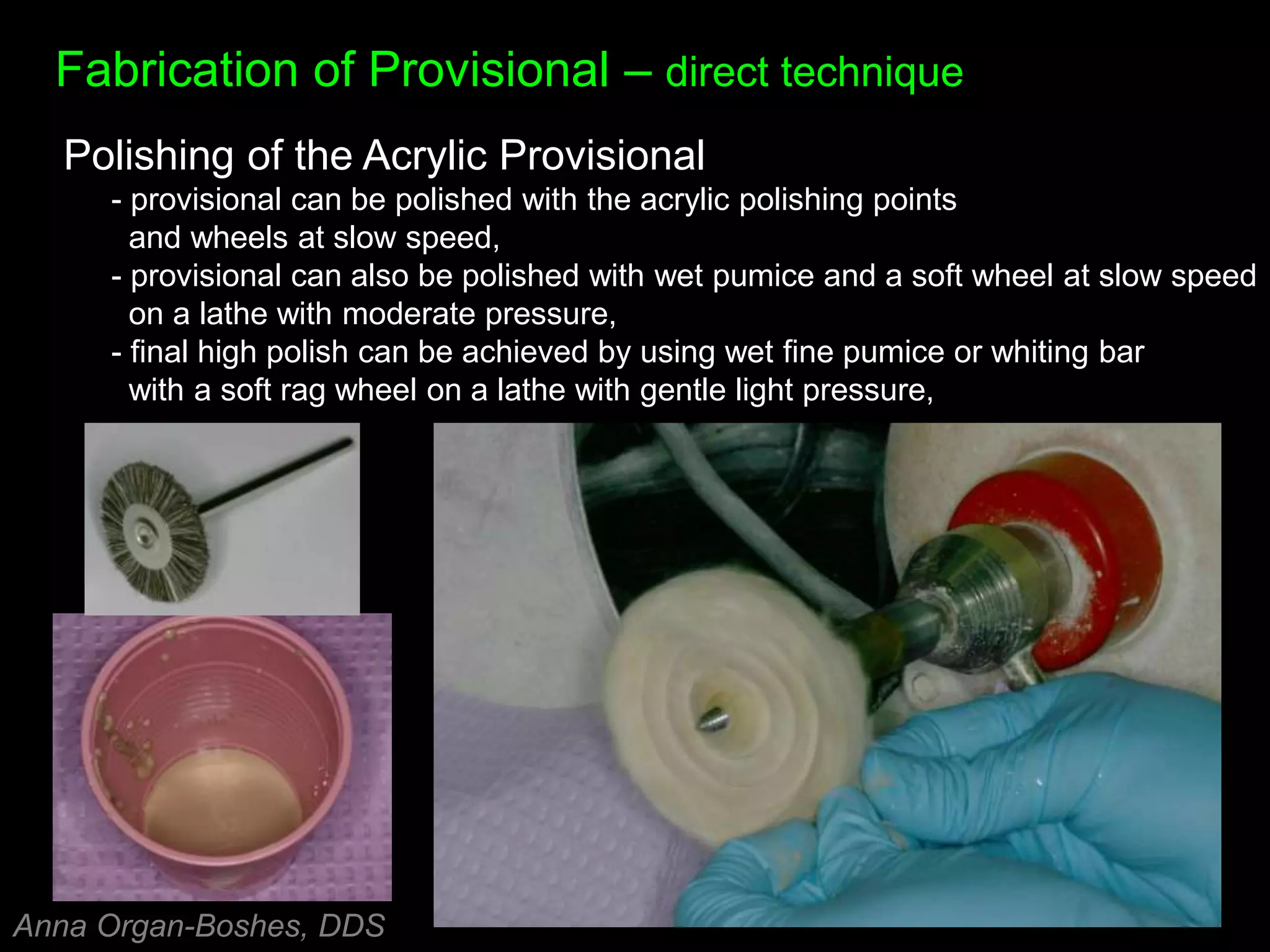 Full gold crown preparation | PPT