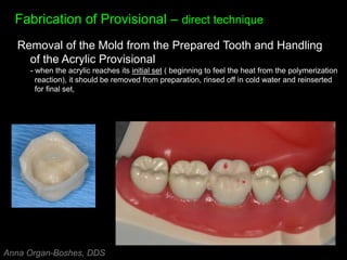 Full gold crown preparation | PPT | Dental Health | Diseases and Conditions