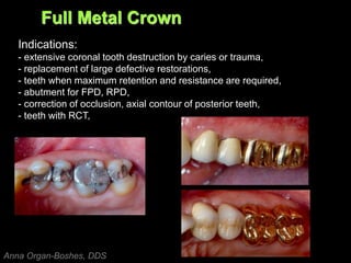 Full gold crown preparation | PPT | Dental Health | Diseases and Conditions