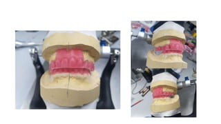 Full immediate process Part 1 by Mike Tapealava | PPT