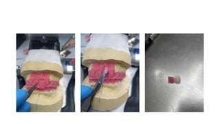 Full immediate process Part 1 by Mike Tapealava | PPT