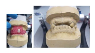 Full immediate process Part 1 by Mike Tapealava | PPT