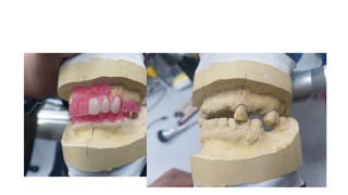 Full immediate process Part 1 by Mike Tapealava | PPT