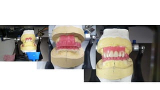 Full immediate process Part 1 by Mike Tapealava | PPT