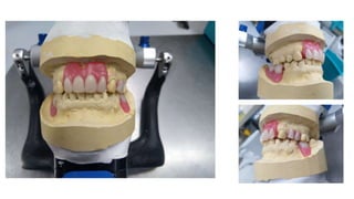 Full immediate process Part 1 by Mike Tapealava | PPT