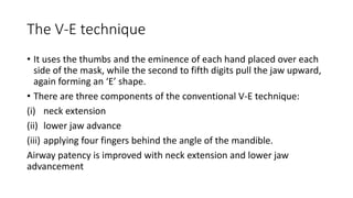 Full Mask Ventilation of CPAP in the ICU.pptx