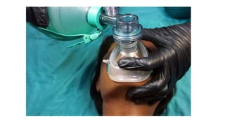 Full Mask Ventilation of CPAP in the ICU.pptx