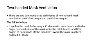Full Mask Ventilation of CPAP in the ICU.pptx