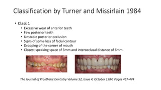 Full mouth reconstruction in prosthodontics and case presentation.pdf