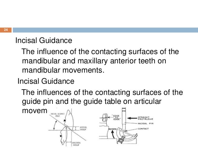 FULL MOUTH REHABILITATION