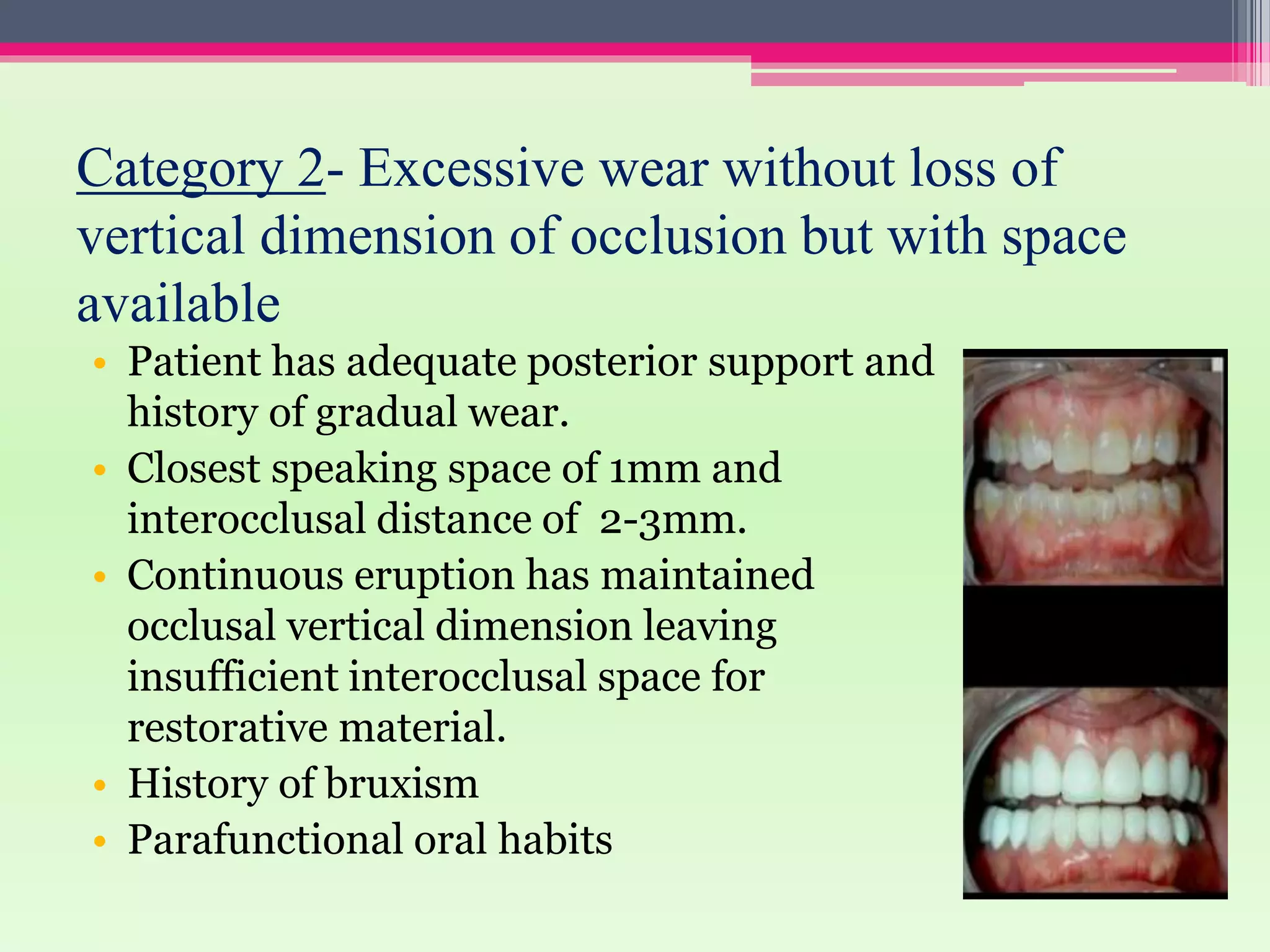 Full mouth rehabilitation | PPTX
