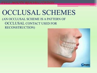 Full mouth rehabilitation | PPTX
