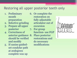 Full mouth rehabilitation | PPTX