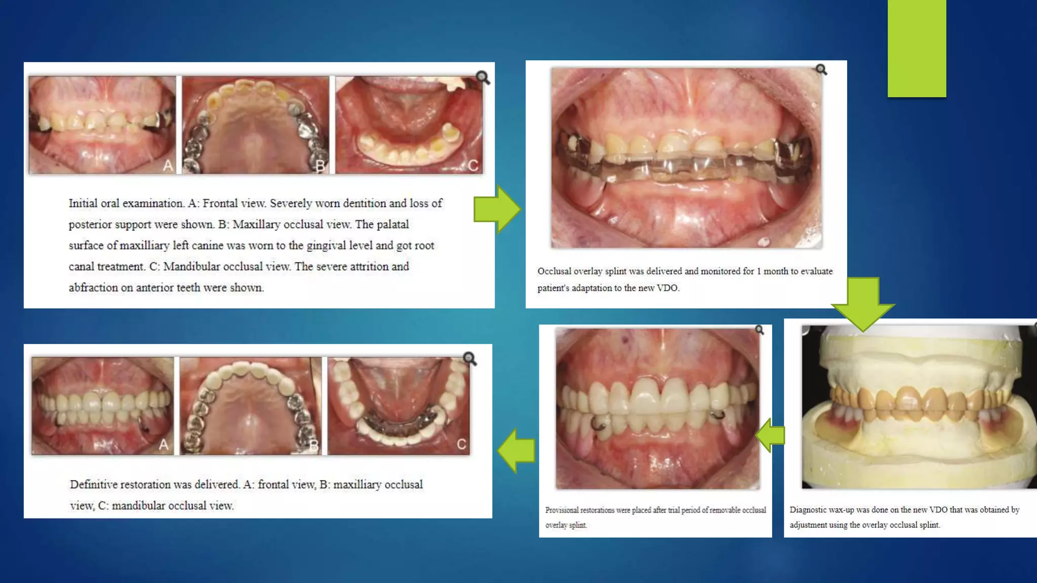 classifications of Full mouth rehabilitation | PPTX
