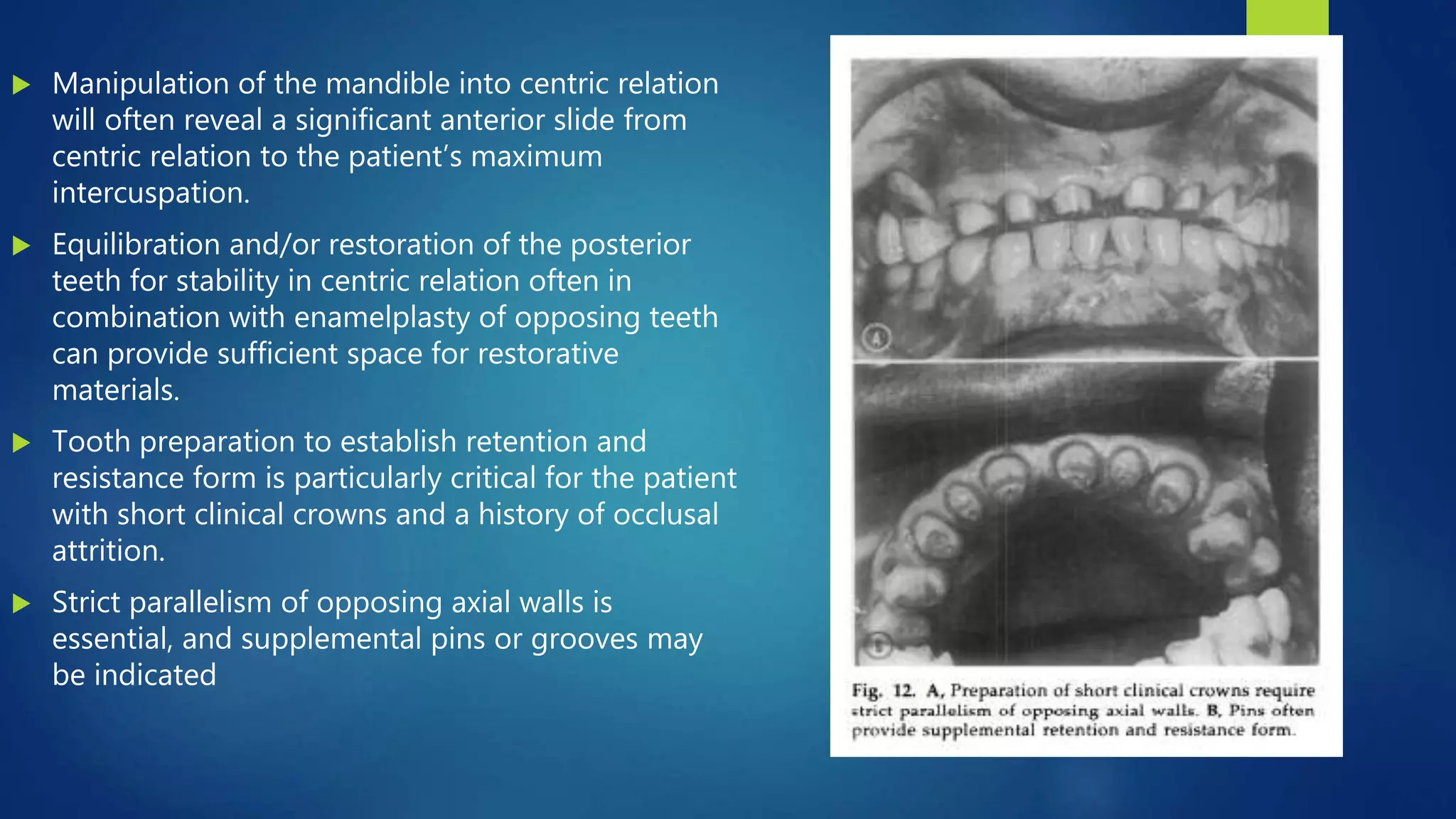 classifications of Full mouth rehabilitation | PPTX