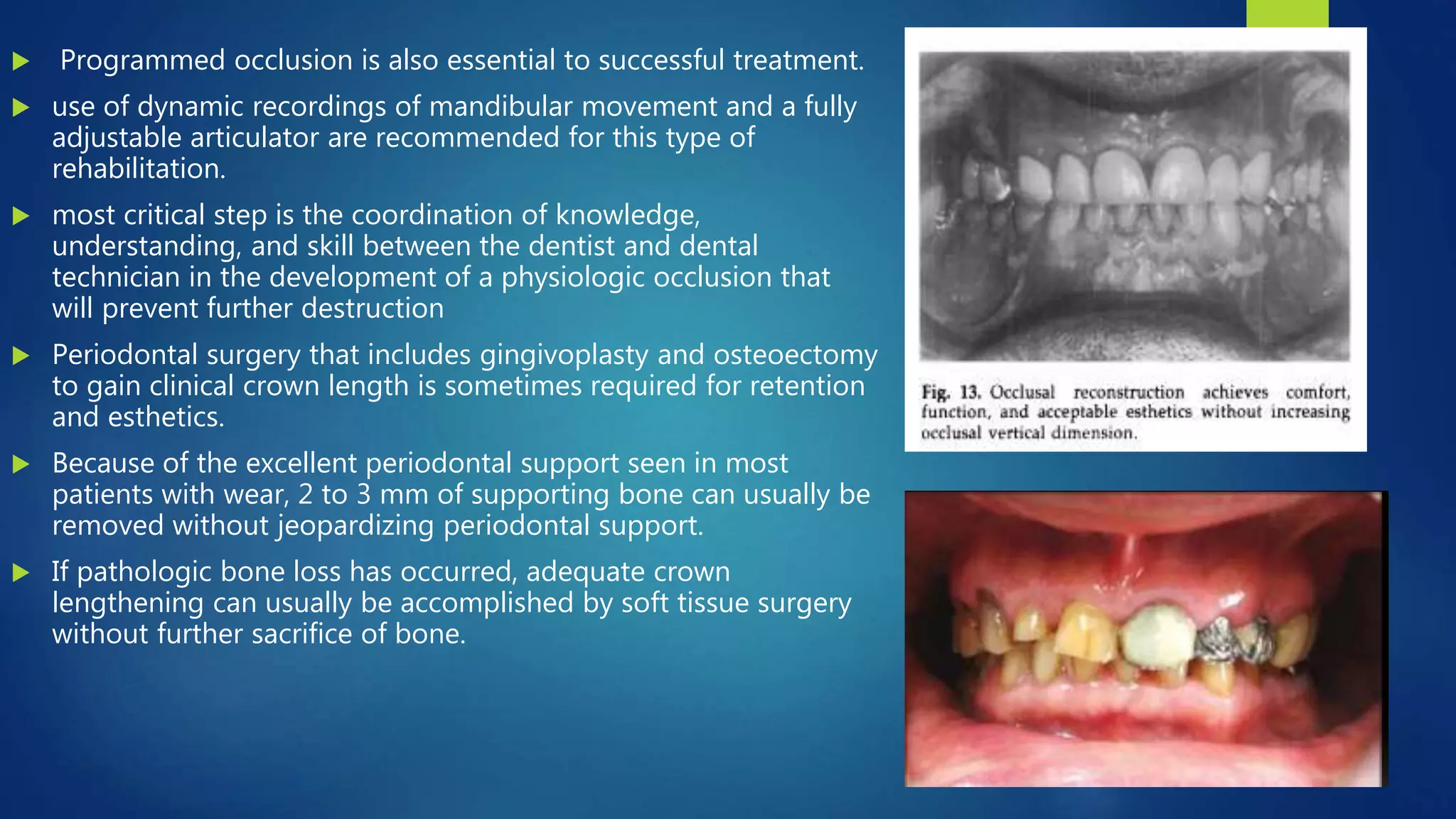 classifications of Full mouth rehabilitation | PPTX