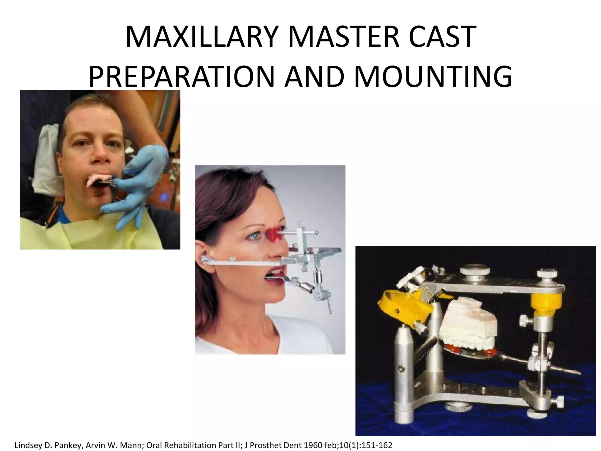 Full mouth rehabilitation using pankey mann schulyer technique | PPTX