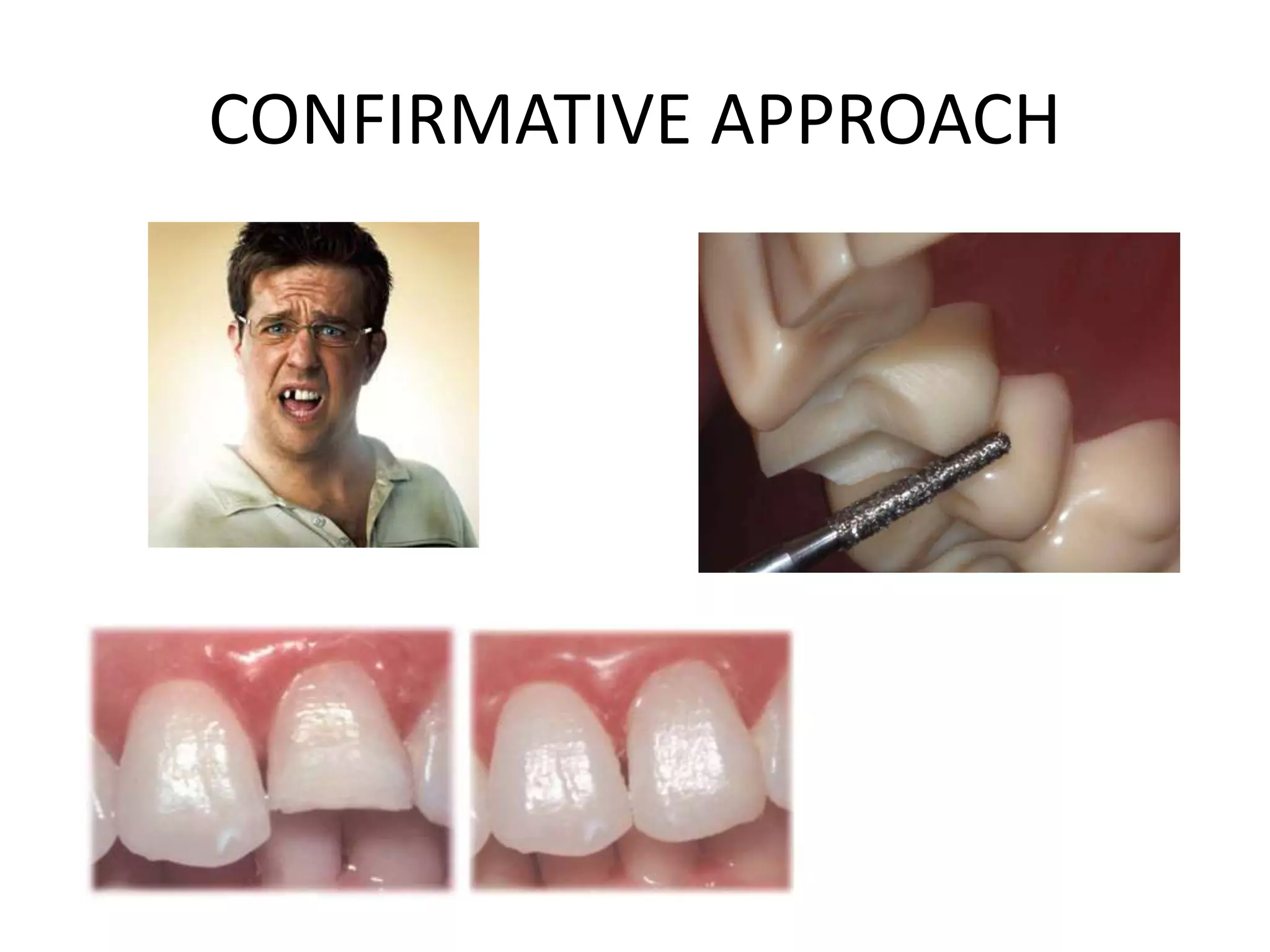 Full mouth rehabilitation using pankey mann schulyer technique | PPTX