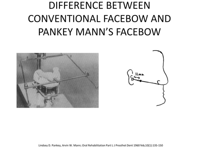 Full mouth rehabilitation using pankey mann schulyer technique | PPTX