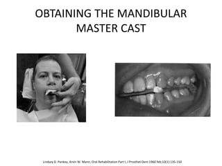 Full mouth rehabilitation using pankey mann schulyer technique | PPTX