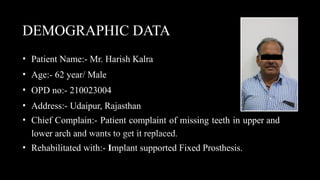 Full Mouth Rehabilitation With Implant-supported prosthesis.pptx