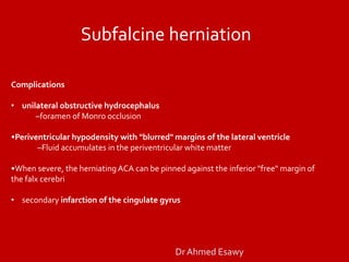 Full story brain herniation imaging Dr Ahmed Esawy | PDF