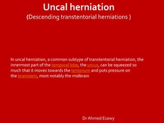Full story brain herniation imaging Dr Ahmed Esawy | PDF