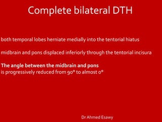 Full story brain herniation imaging Dr Ahmed Esawy | PDF