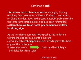 Full story brain herniation imaging Dr Ahmed Esawy | PDF