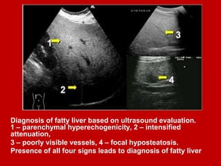 Ultrasound Images Of Fatty Liver