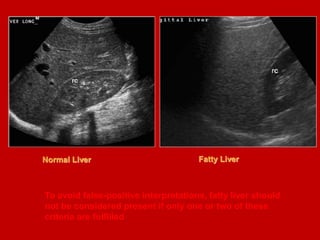 Ultrasound Images Of Fatty Liver