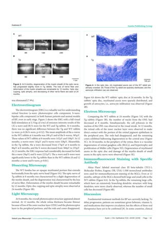 Austin Journal of Clinical Ophthalmology | PDF