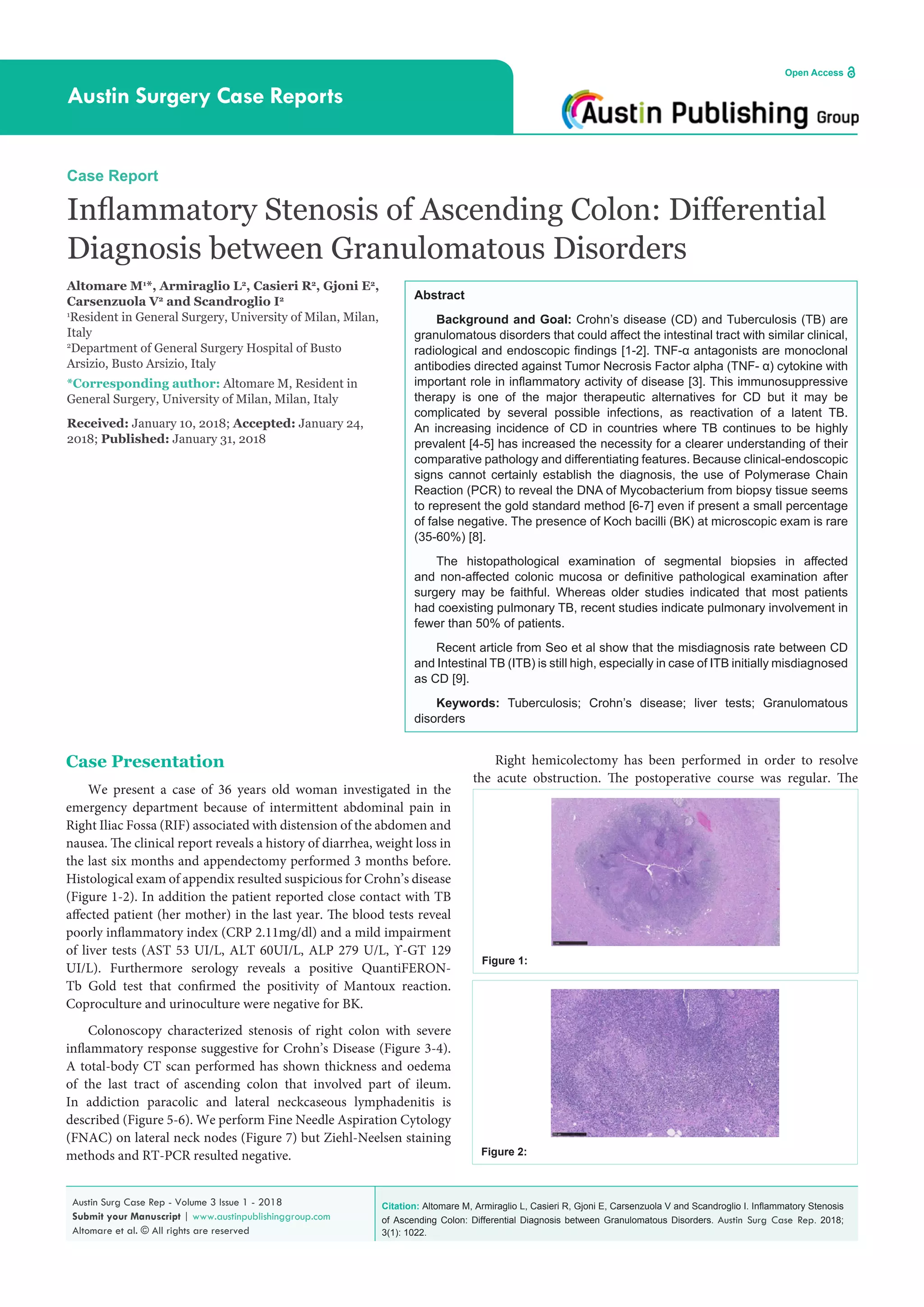 Austin Surgery Case Reports | PDF