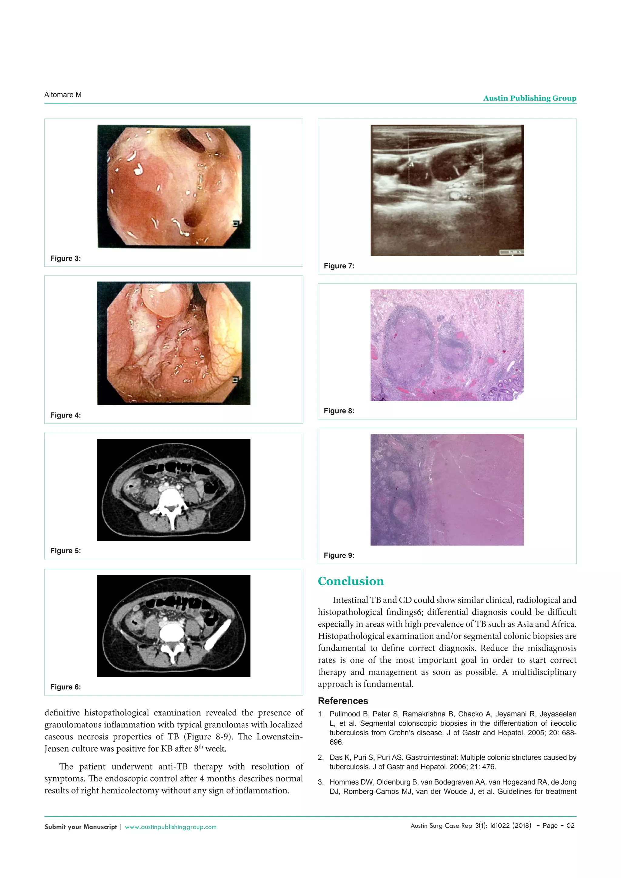 Austin Surgery Case Reports | PDF