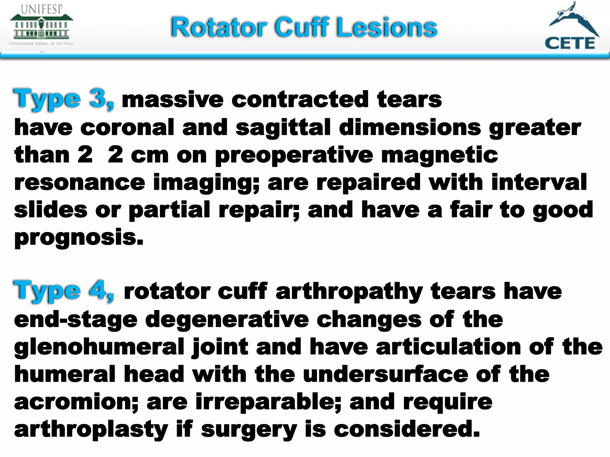 Full thickness rotator cuff: Diagnosis and Management | PDF