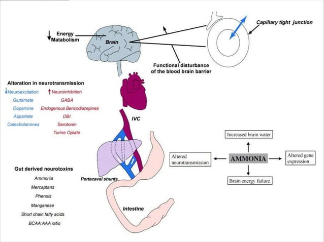 Fulminant hepatic failure (fhf) | PPTX
