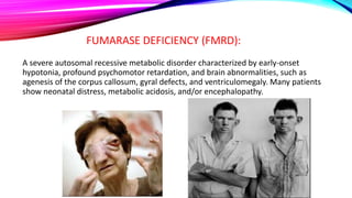 Fumarase enzyme | PPTX