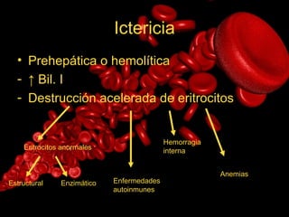 Funcion Hepatica E Ictericia | PPT