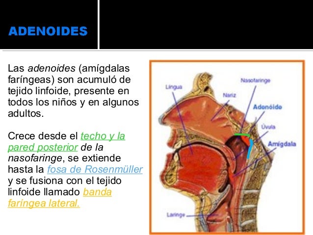 Funcionales adenoiditis