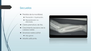 Funcionalidad del codo | PPTX