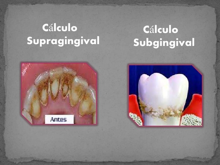 Tema Funcion del Calculo
