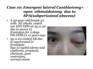 Functional endoscopic sinus surgery complicated with orbital hemorrhage ...