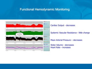 Functional-Hemodynamic-Monitoring-for-CRNA-handout.ppt