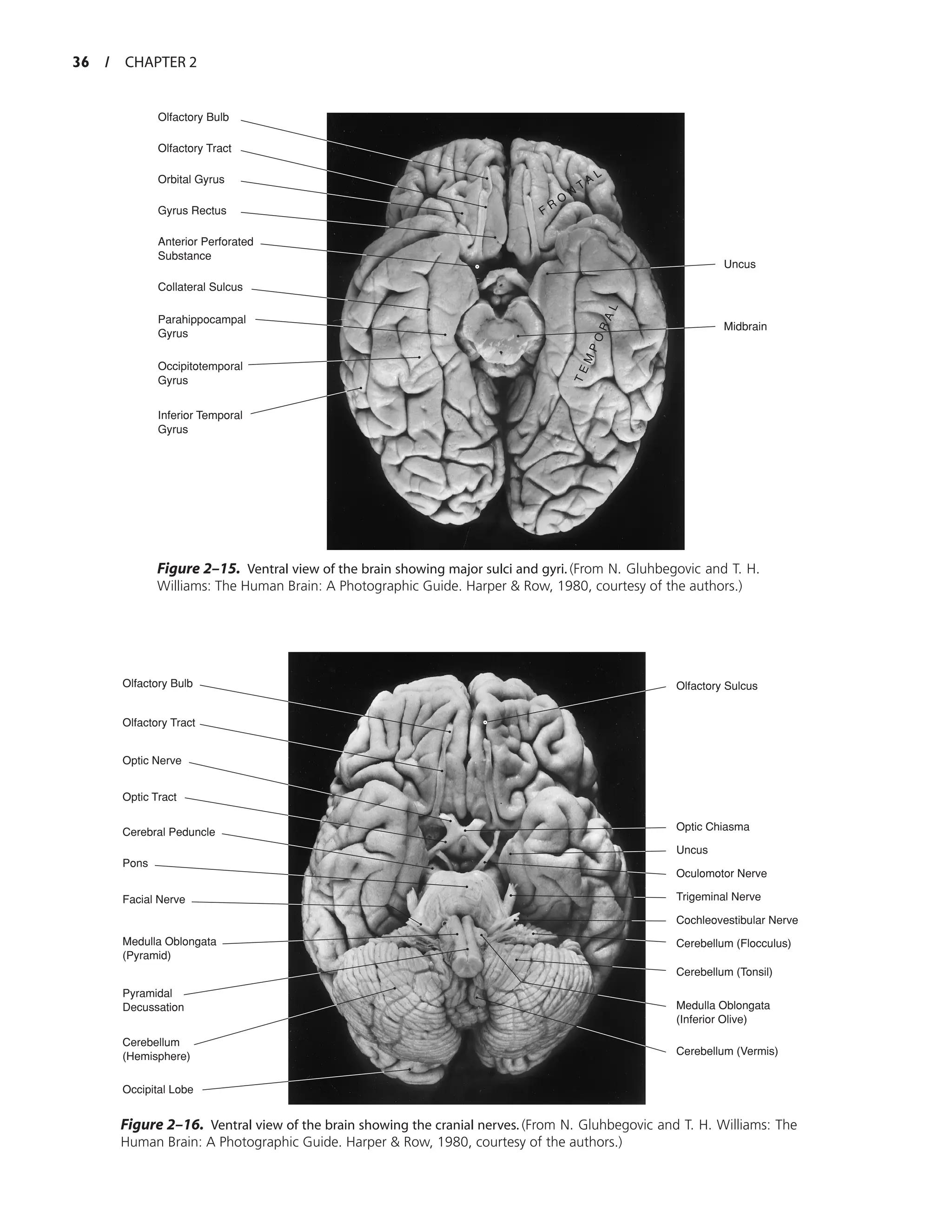 Functional Neuroanatomy Text And Atlas 2nd Ed 9780071408127 0071408126 Pdf