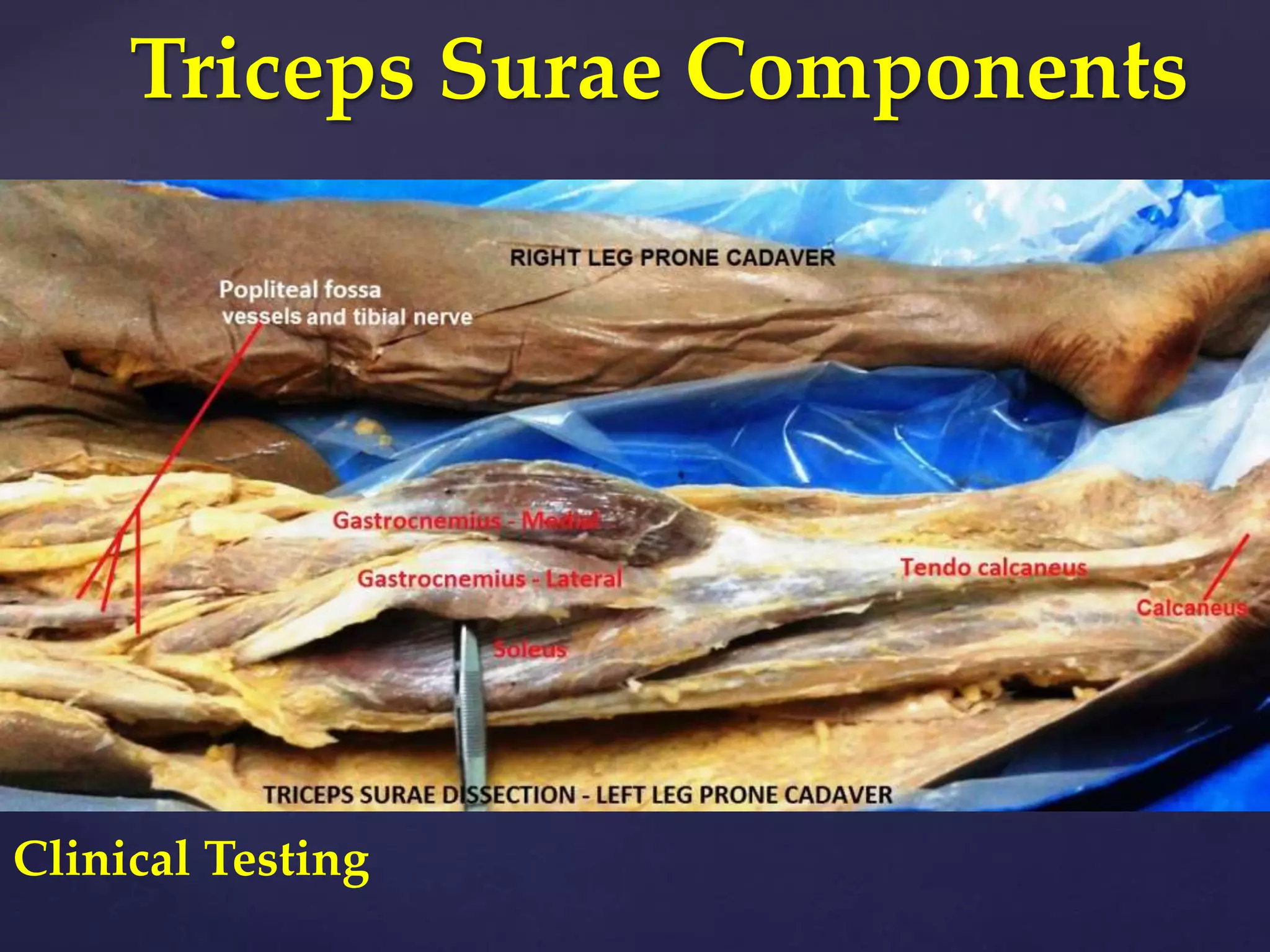Functional Surgical Aspects -Triceps Surae-Tendo Calcaneus - Sanjoy ...