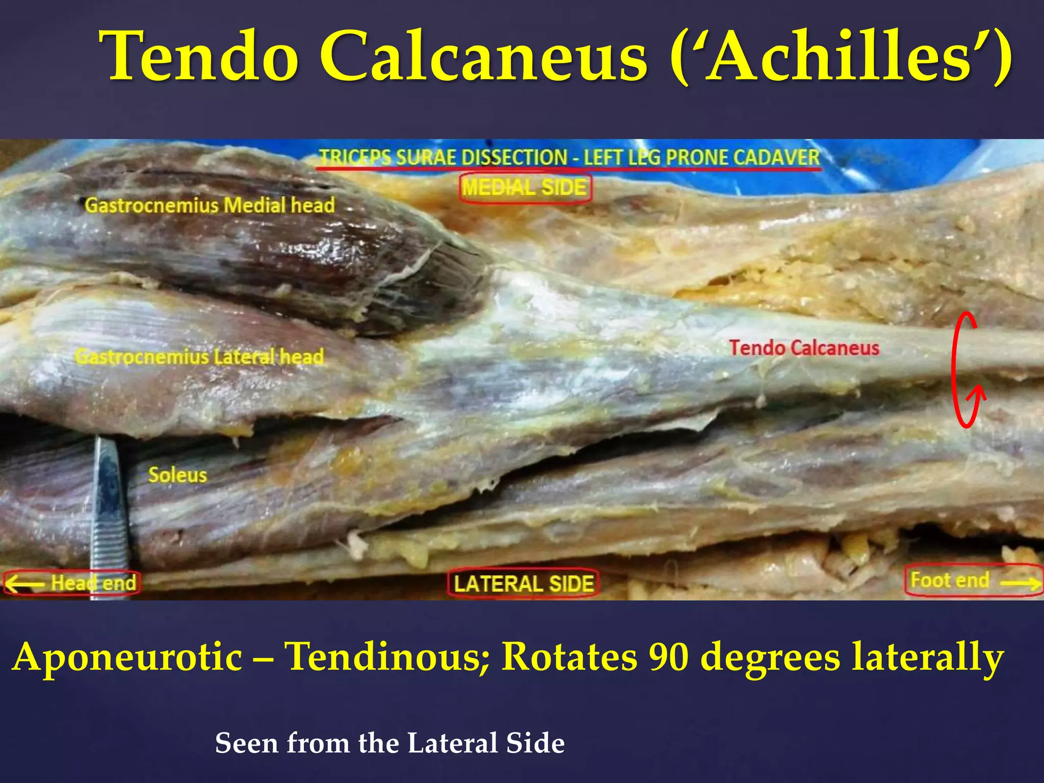 Functional Surgical Aspects -Triceps Surae-Tendo Calcaneus - Sanjoy ...