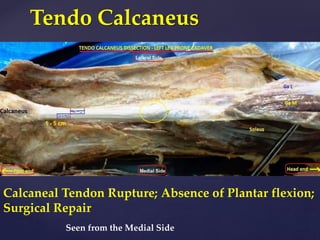 Functional Surgical Aspects -Triceps Surae-Tendo Calcaneus - Sanjoy ...