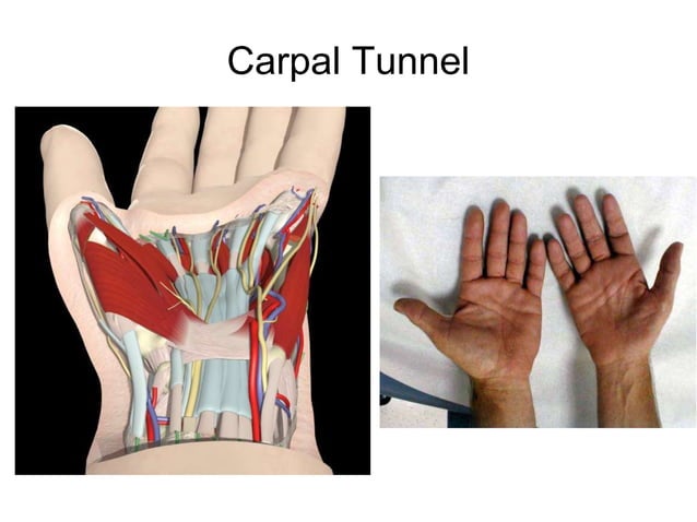 Functional Anatomy Hand | PPT