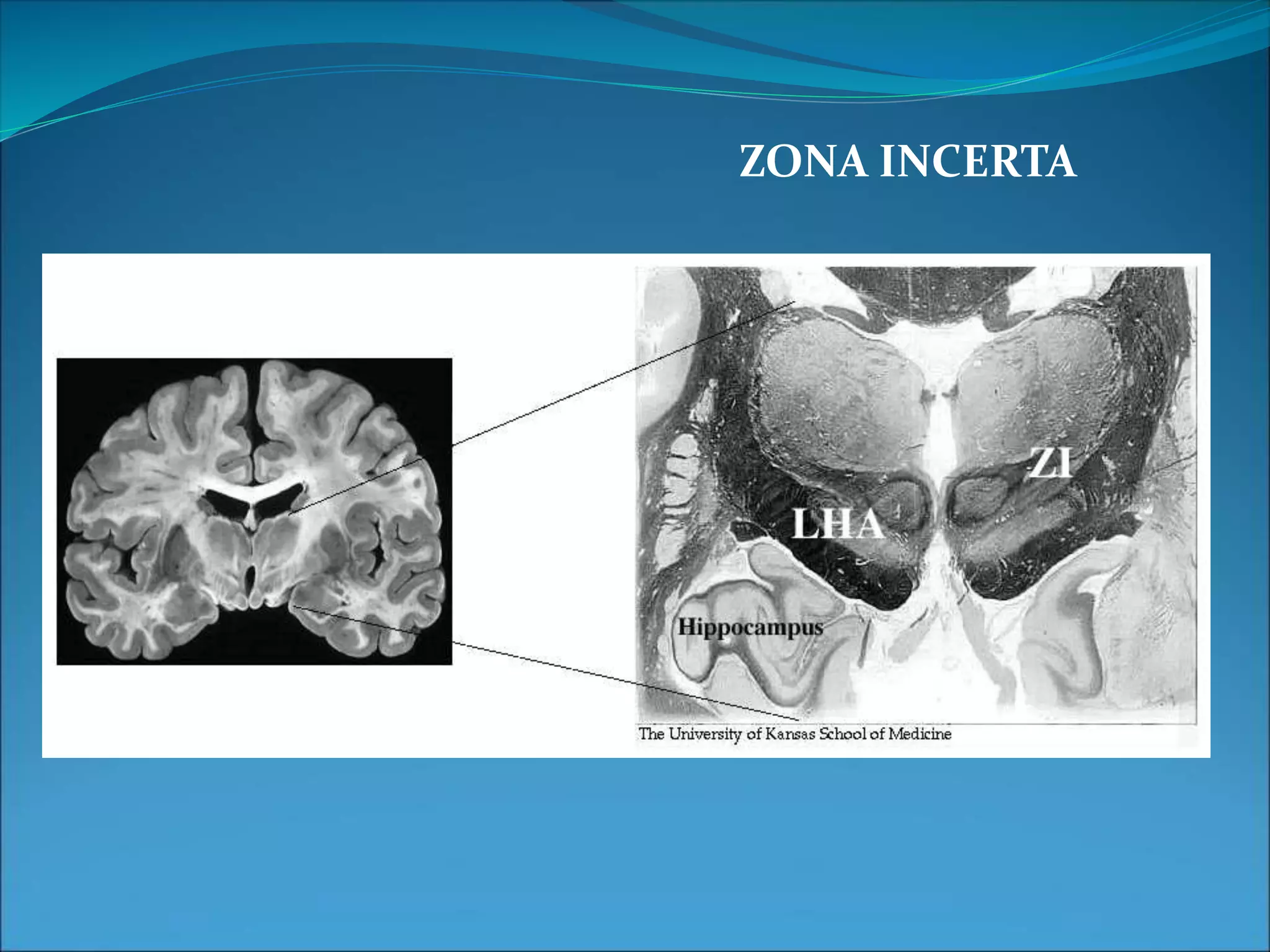 FUNCTIONAL_ANATOMY_OF_BASAL_GANGLIA.ppt